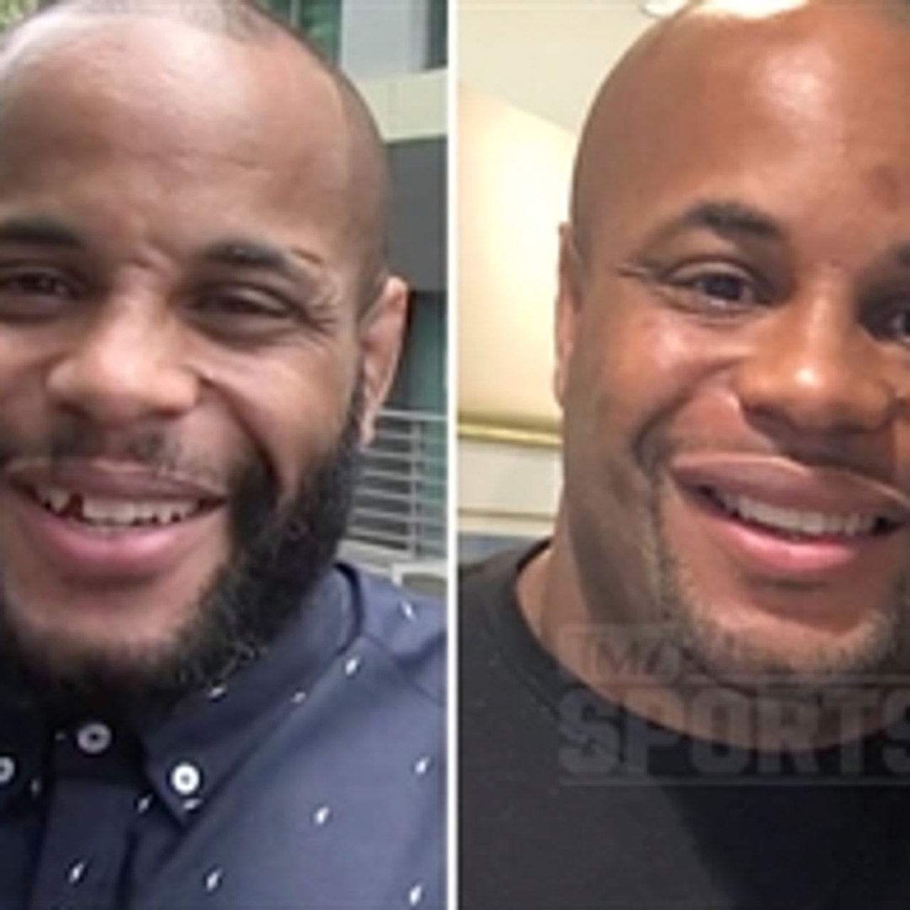 mike tyson gap teeth