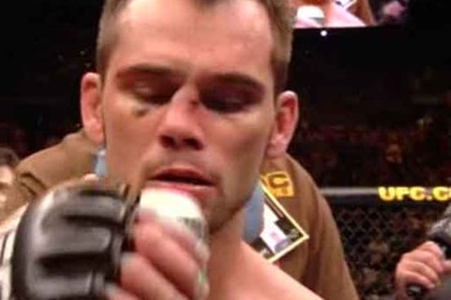 MMA fighter rocks the worst broken nose you've ever seen | FOX Sports