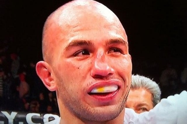 MMA fighter rocks the worst broken nose you've ever seen | FOX Sports