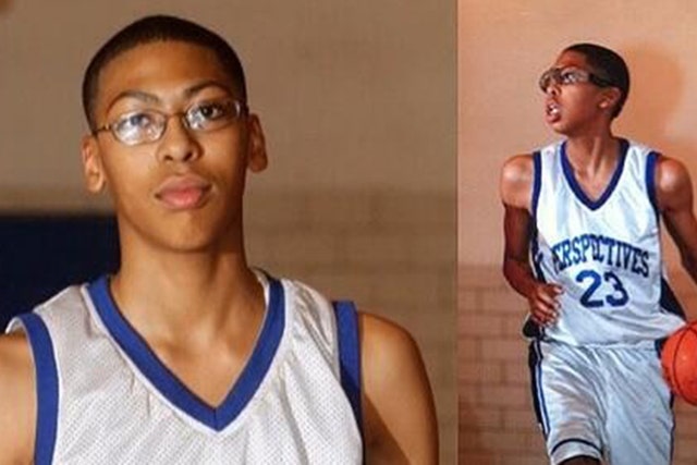 anthony davis before braces