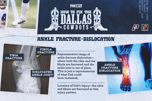 dislocated ankle timeline