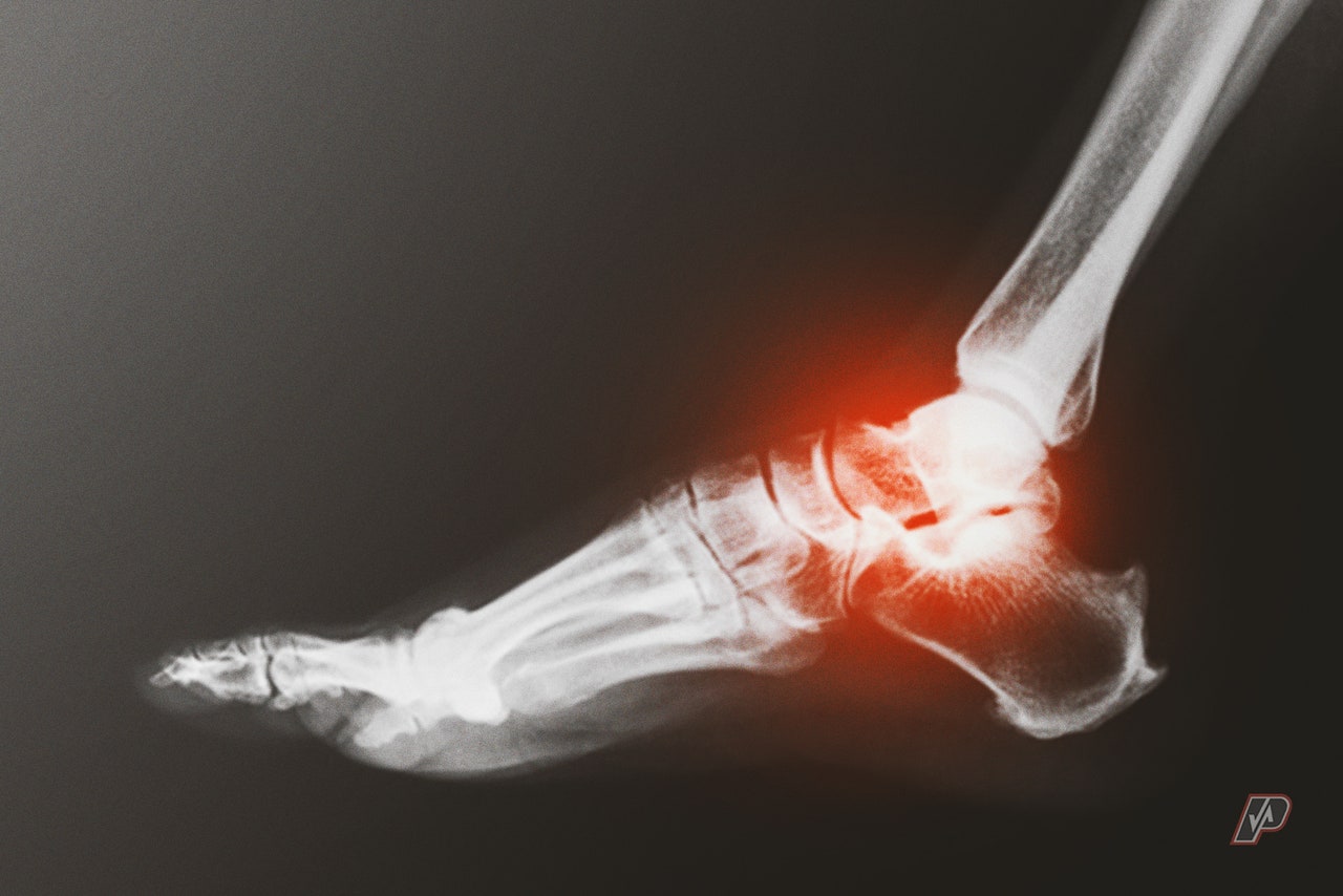 Dr. Matt Provencher breaks down Tiger Woods' injuries and what's next ...